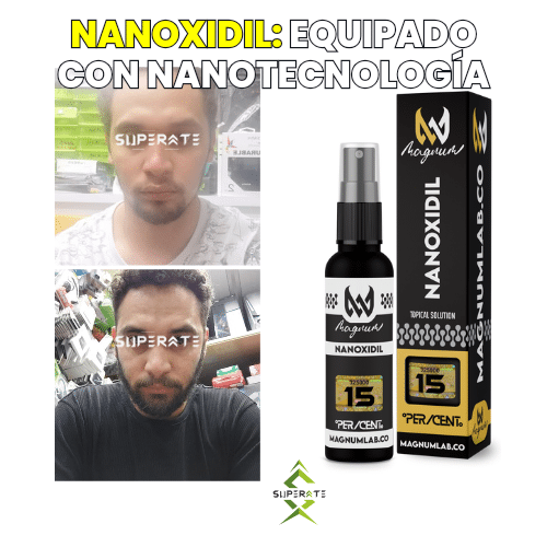 Nanoxidil - Magnum 60 ml + Biotina 15.000 mcg en Gotas Magnum GRATIS